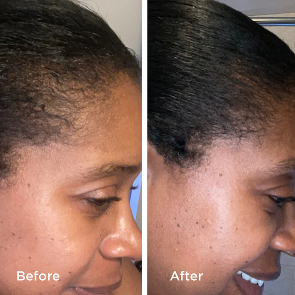 Rice Water Ritual Set - 3-Step Rice Water Hair Care System – Promotes ...